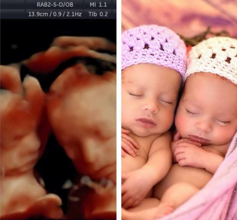Baby Boo let parents visualize and mount 3D models of their unborn babies